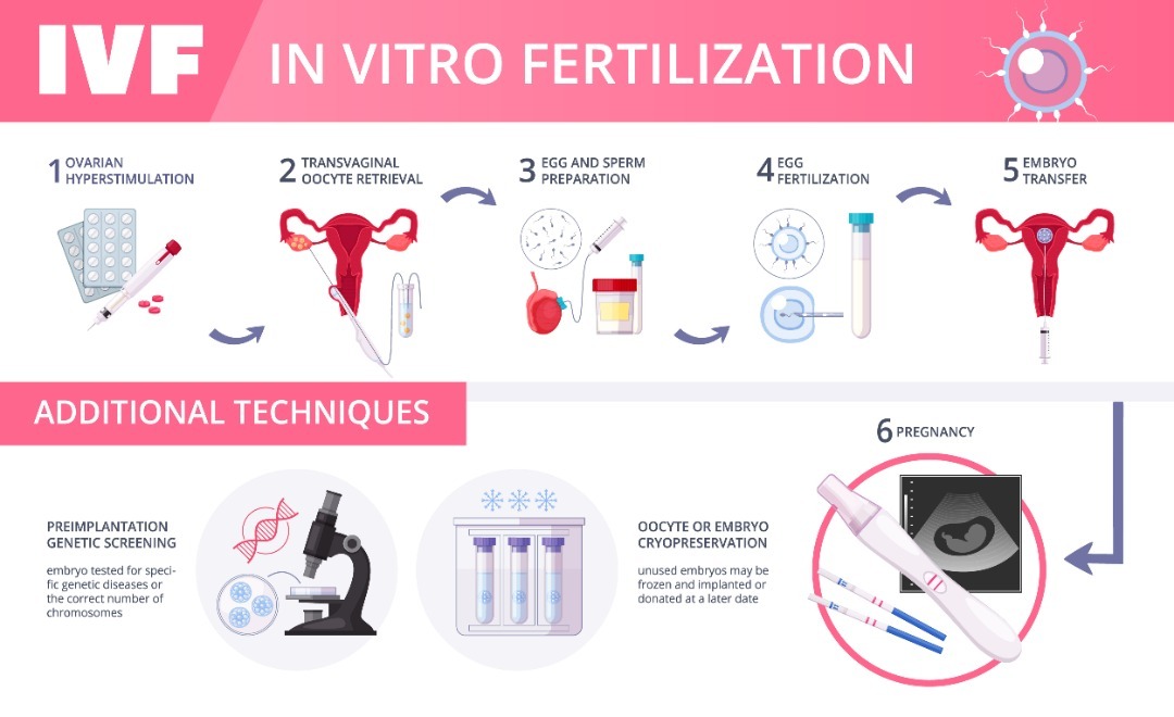 Langkah-langkah – Vistana Fertility Centre